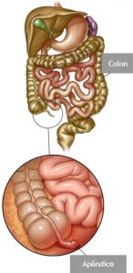 Apendicite - Progastro