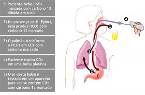 Teste respiratório para H. Pylori - Progastro